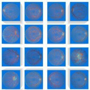 DRIVE Dataset – Machine Learning Datasets